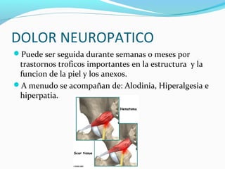 Clasificacion Fisiopatologica del Dolor. | PPT