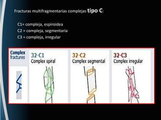 Clasificacion fracturas | PPT