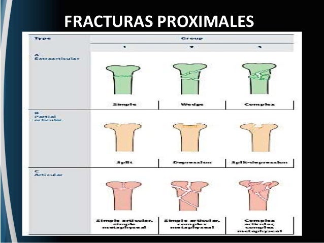 Clasificacion fracturas