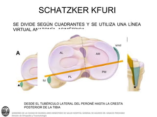 CLASIFICACION FX PLATILLO tibial modificada por kfuri | PPTX