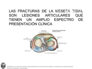 CLASIFICACION FX PLATILLO tibial modificada por kfuri | PPTX