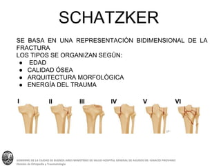 CLASIFICACION FX PLATILLO tibial modificada por kfuri | PPTX