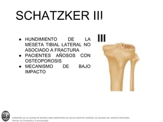 CLASIFICACION FX PLATILLO tibial modificada por kfuri | PPTX