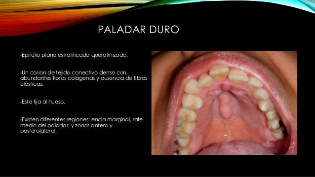 Clasificacion histotopografica y funcional de la mucosa