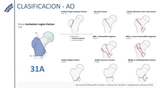 CLASIFICACION Y TRATAMIENTO LAS FRACTURAS CADERA | PPTX