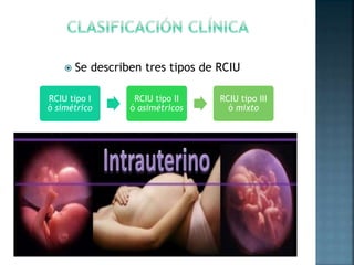 Clasificacion RCI | PPTX