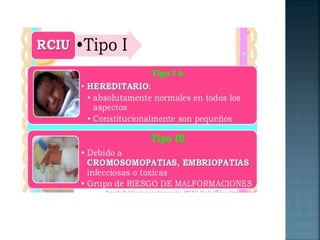 Clasificacion RCI | PPTX