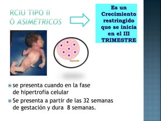 Clasificacion RCI | PPTX