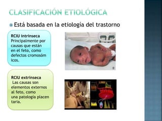 Clasificacion RCI | PPTX