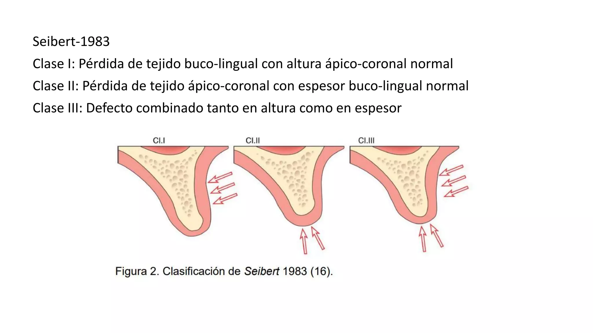 clasificacion reabsorcion osea.pptx