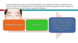 Clasificacion Ti Rads | PPT