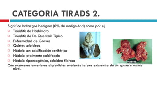 Clasificacion Ti Rads | PPT