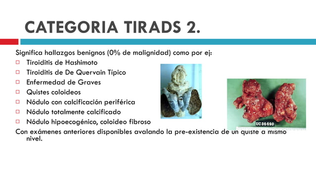 Clasificacion Ti Rads