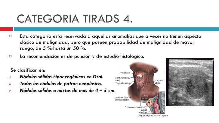 Clasificacion Ti Rads