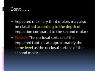 Clasification of ma xillary impacted teeth | PPTX