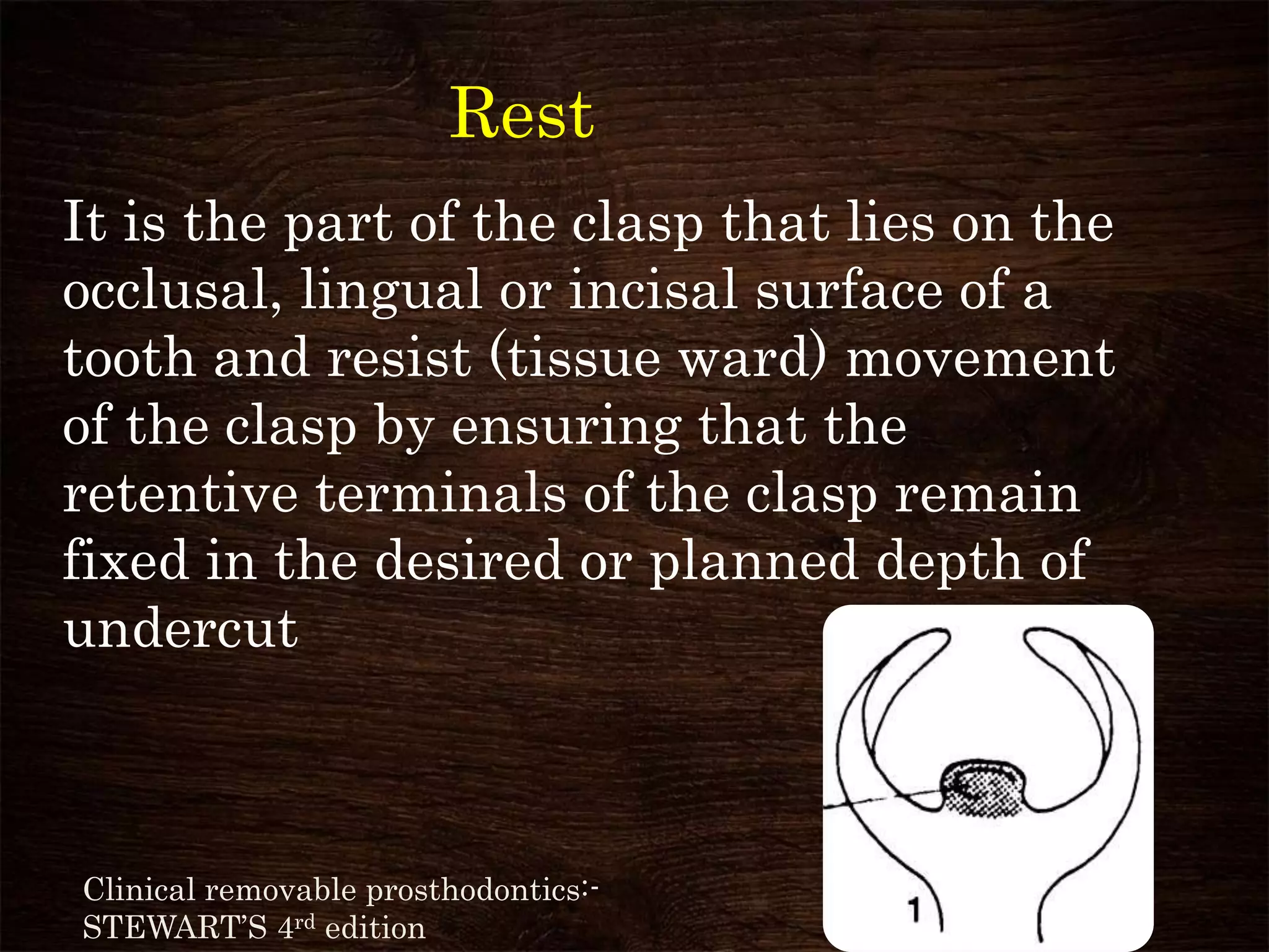 Clasp Designs - Dr. devi | PPTX