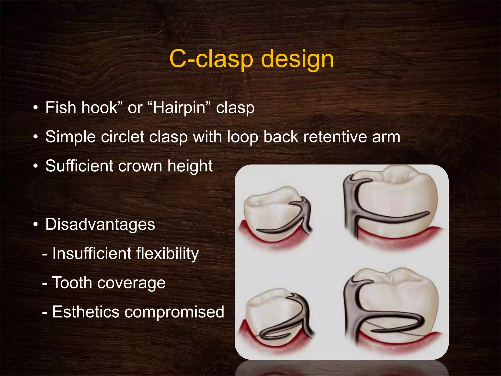 Clasp Designs - Dr. devi | PPTX