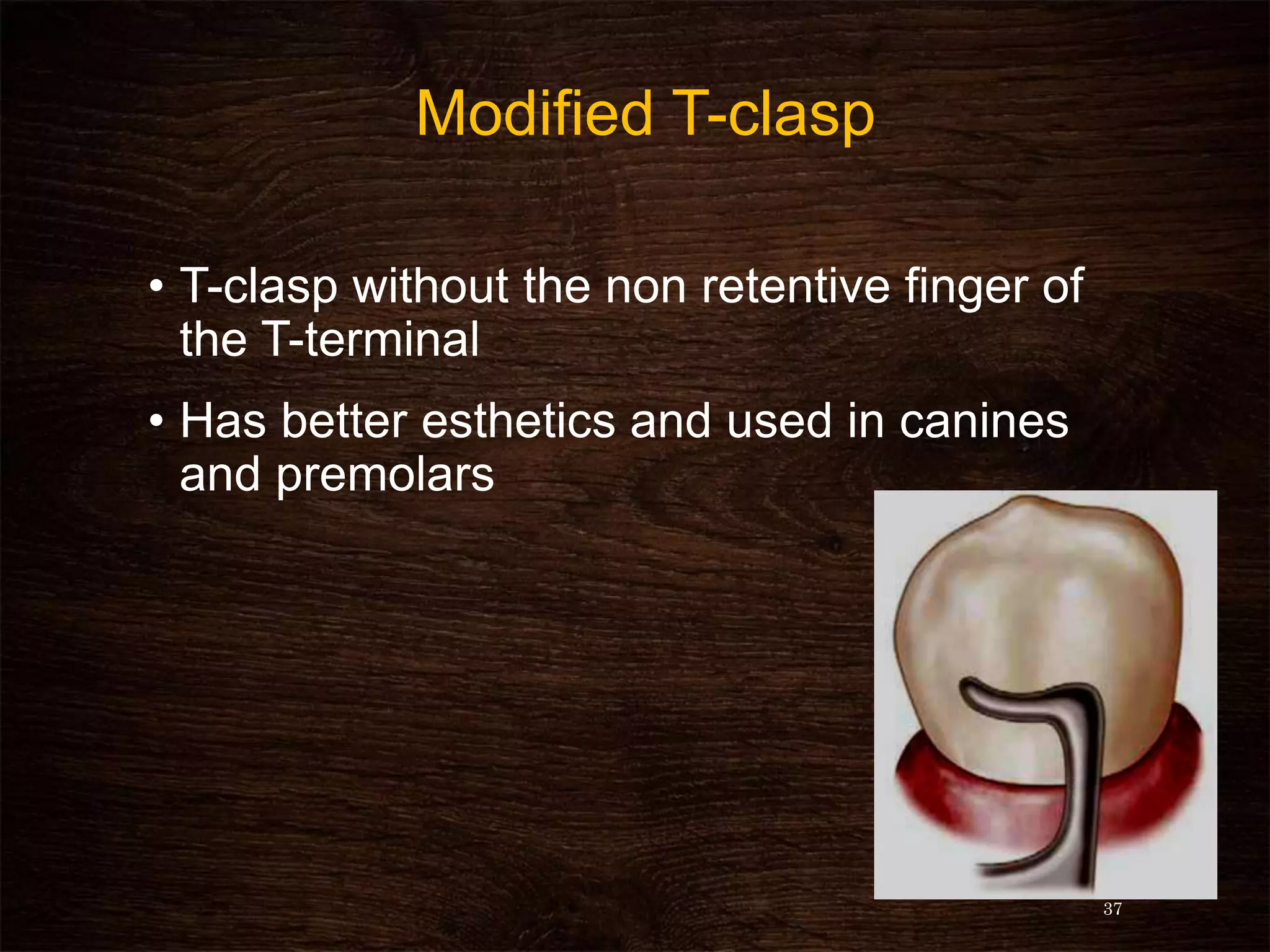 Clasp Designs - Dr. devi | PPTX