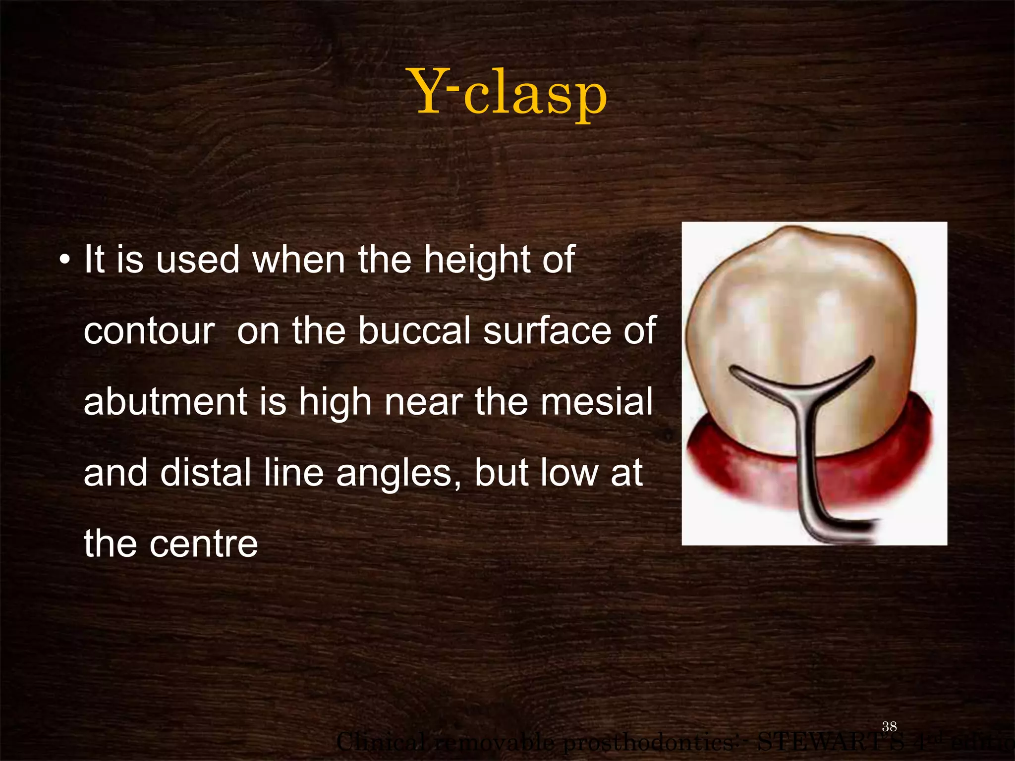 Clasp Designs - Dr. devi | PPTX