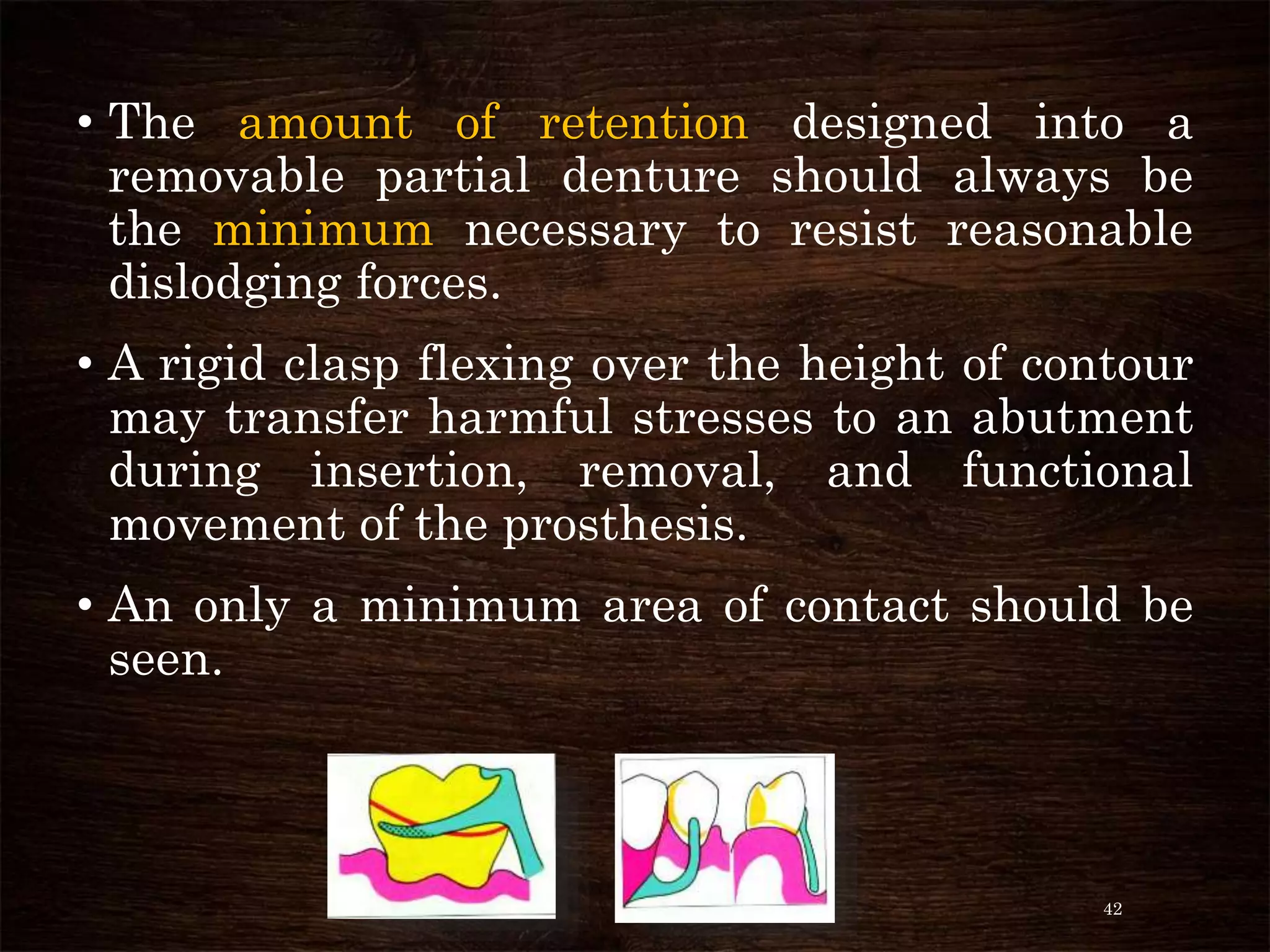 Clasp Designs - Dr. devi | PPTX