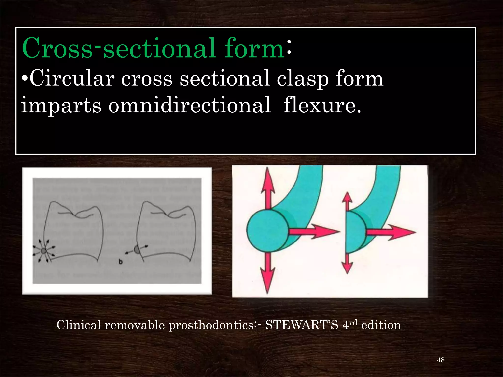 Clasp Designs - Dr. devi | PPTX