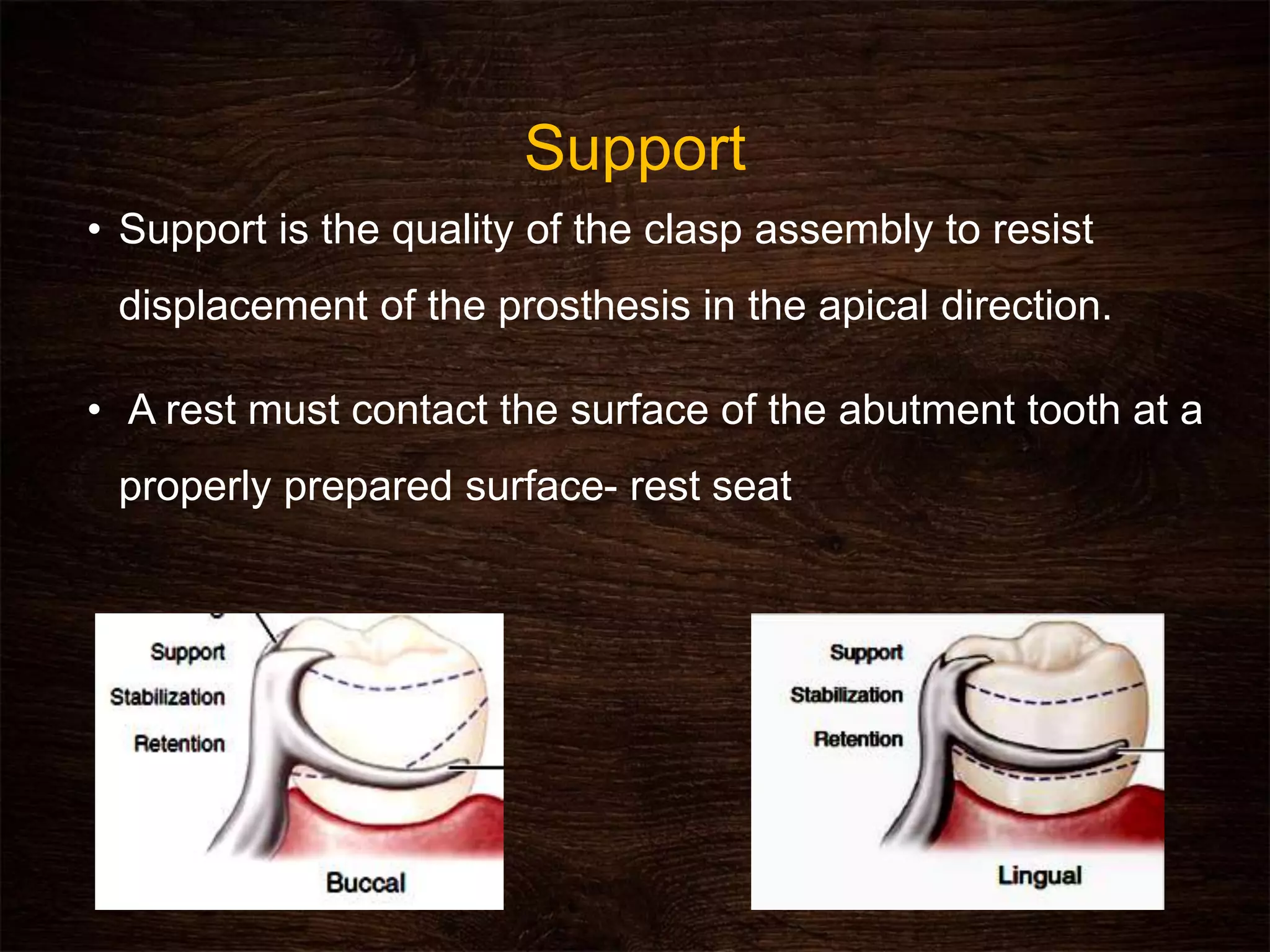 Clasp Designs - Dr. devi | PPTX