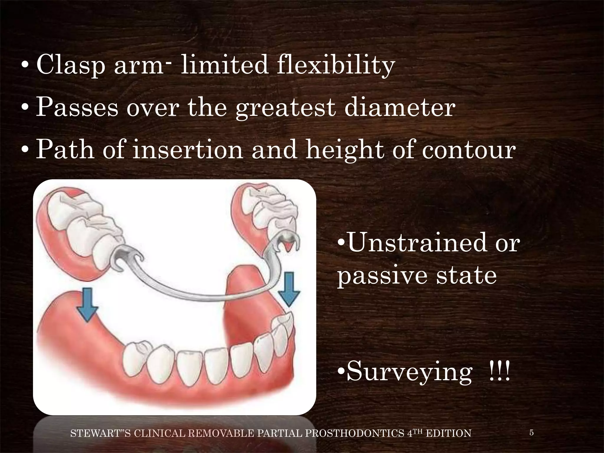 Clasp Designs - Dr. devi | PPTX