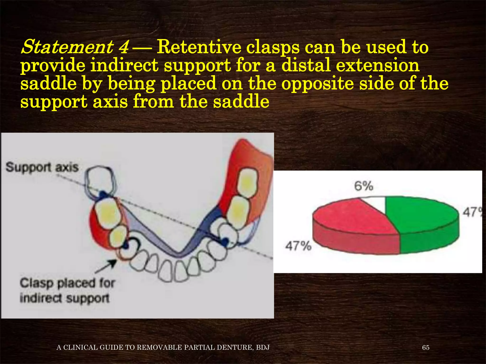 Clasp Designs - Dr. devi | PPTX