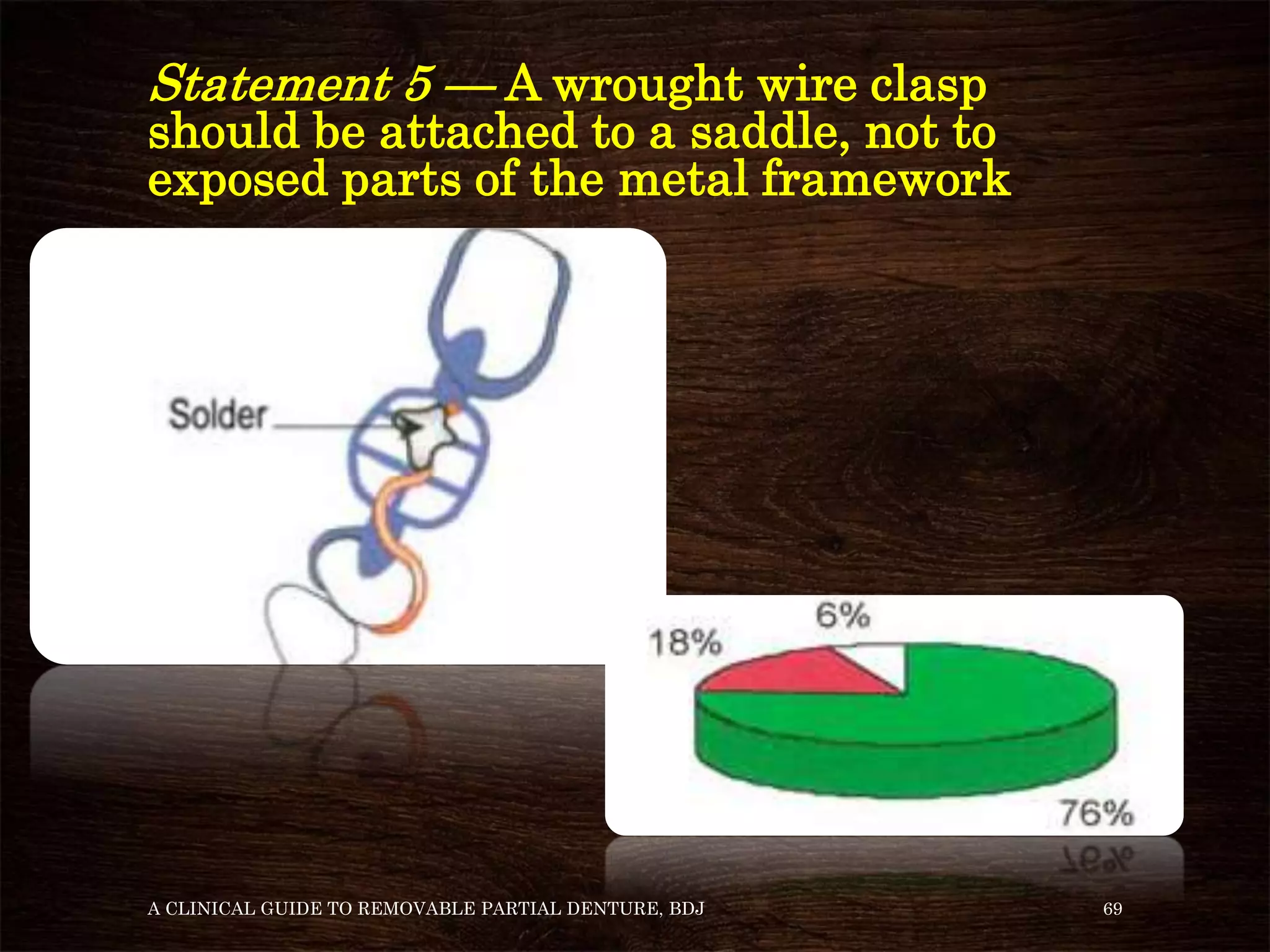 Clasp Designs - Dr. devi | PPTX