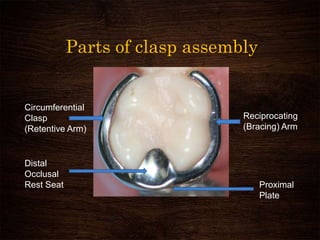 Clasp Designs - Dr. devi | PPTX