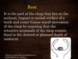 Clasp Designs - Dr. devi | PPTX