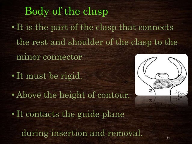 Clasp Designs - Dr. devi | PPTX