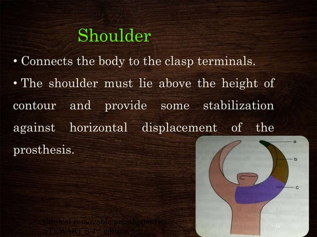 Clasp Designs - Dr. devi | PPTX