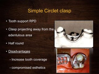 Clasp Designs - Dr. devi | PPTX