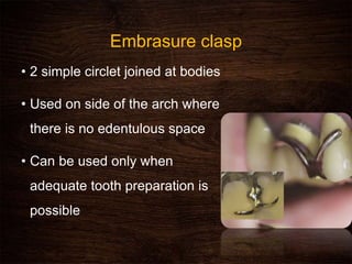 Clasp Designs - Dr. devi | PPTX