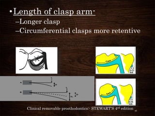 Clasp Designs - Dr. devi | PPTX