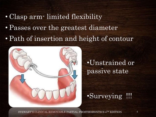 Clasp Designs - Dr. devi | PPTX