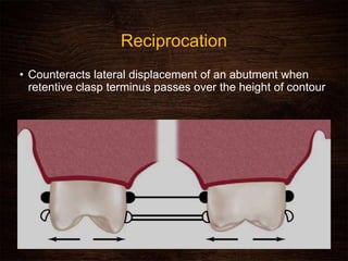 Clasp Designs - Dr. devi | PPTX