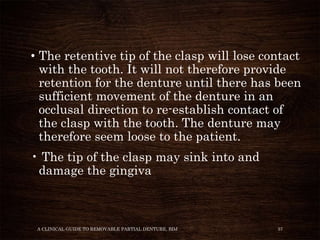 Clasp Designs - Dr. devi | PPTX