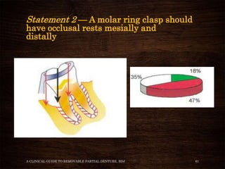 Clasp Designs - Dr. devi | PPTX