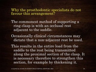 Clasp Designs - Dr. devi | PPTX