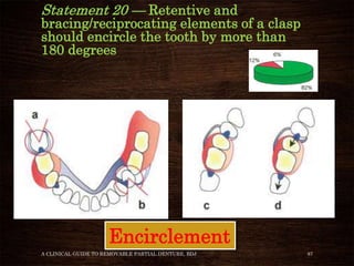 Clasp Designs - Dr. devi | PPTX