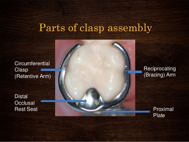 Clasp Designs - Dr. devi