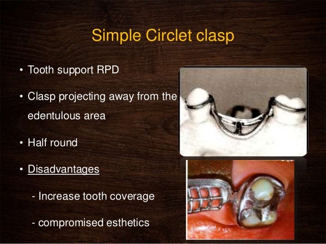 Clasp Designs - Dr. devi