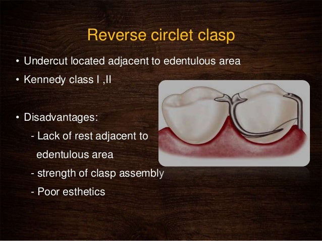 Clasp Designs - Dr. devi