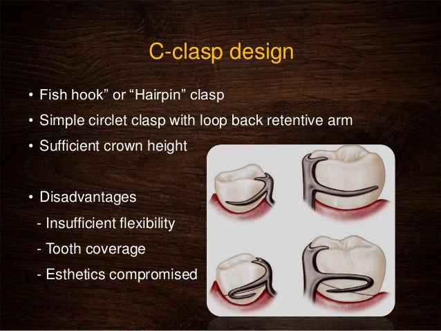 Clasp Designs - Dr. devi