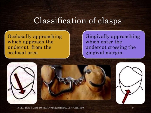 Clasp Designs - Dr. devi