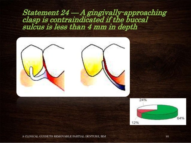 Clasp Designs - Dr. devi