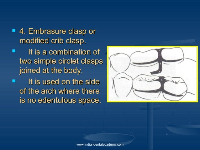 Clasp designs / dentist technology