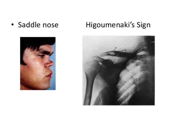 Congenital Syphillis, Reccurent Apthae, Behcets and Reiter's Syndrome…